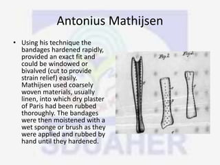 Plaster of paris | PPTX