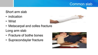 plaster of paris best1.pptx