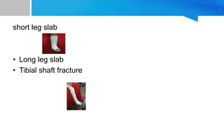 plaster of paris best1.pptx