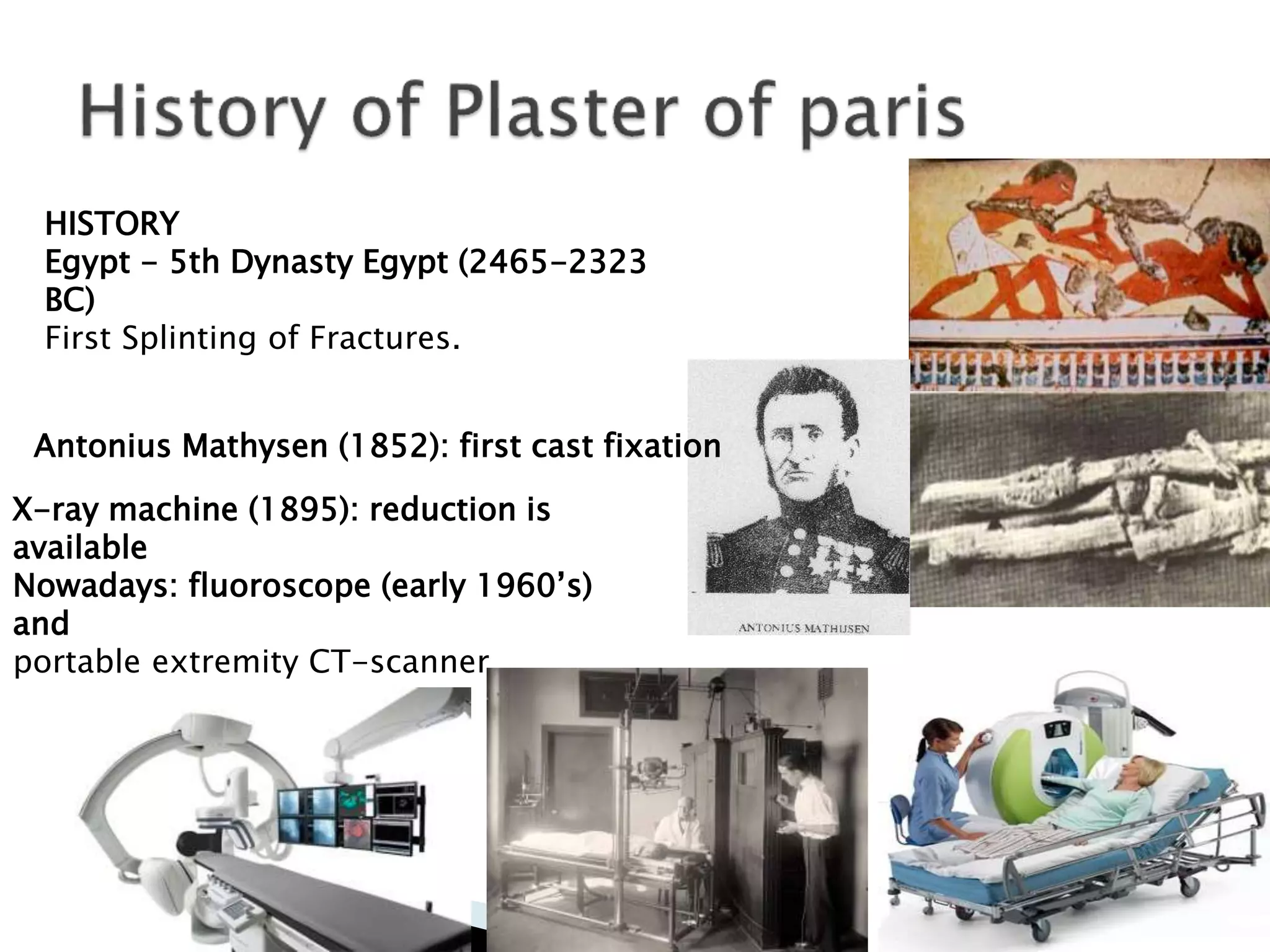 Plaster of paris ortho presentation | PPTX