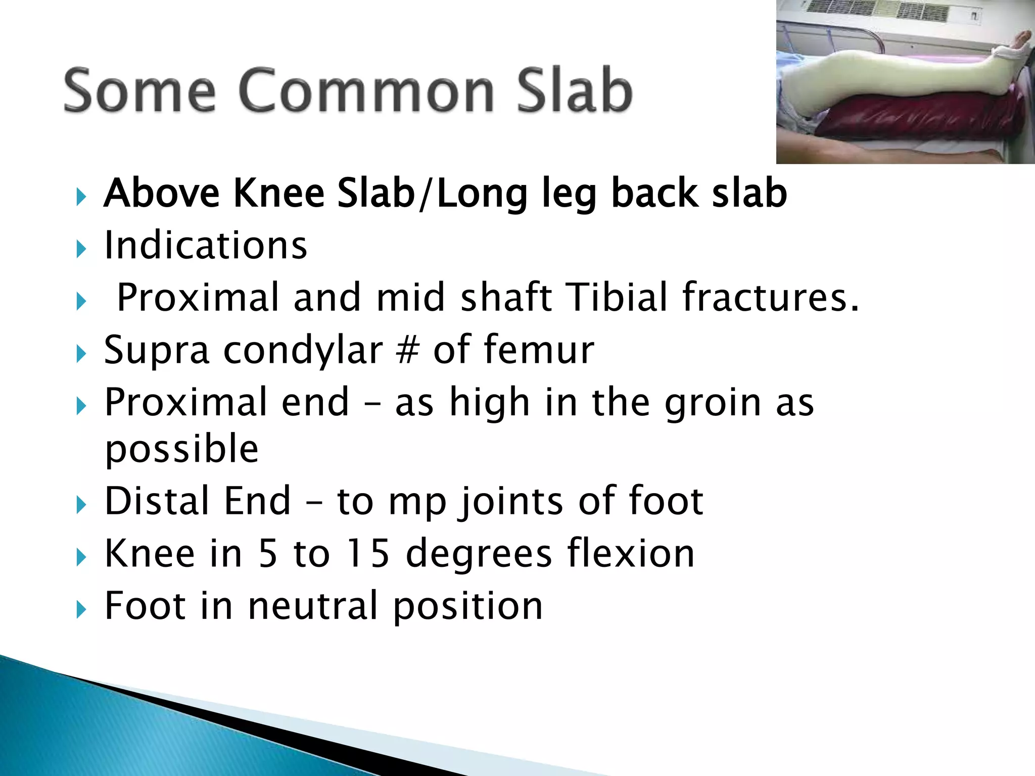 Plaster of paris ortho presentation | PPTX