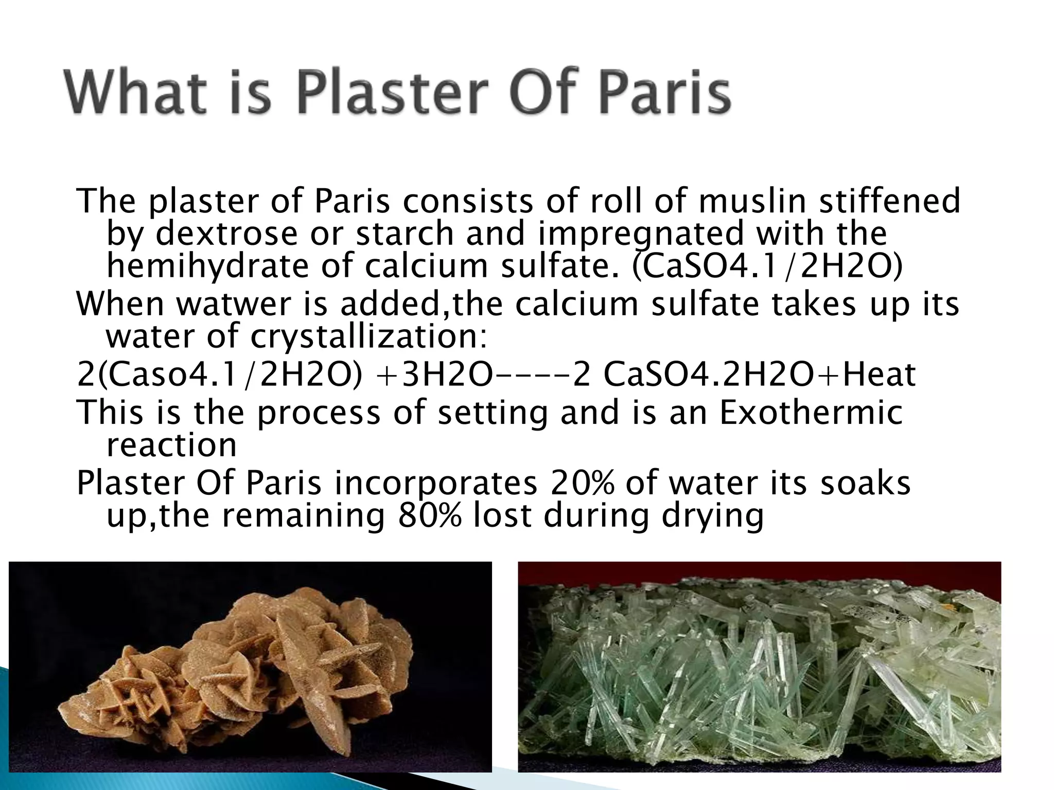 Plaster of paris ortho presentation | PPTX