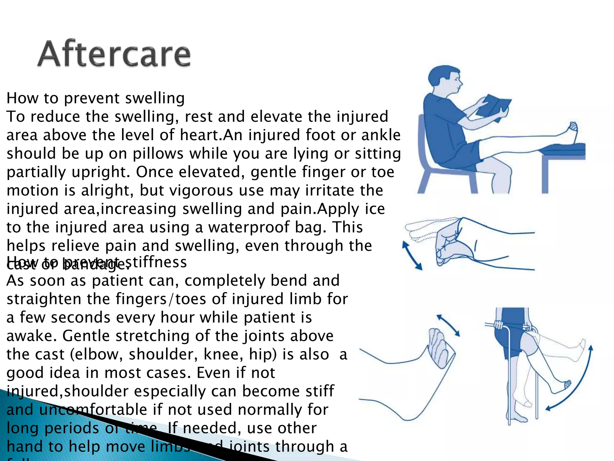 Plaster of paris ortho presentation | PPTX