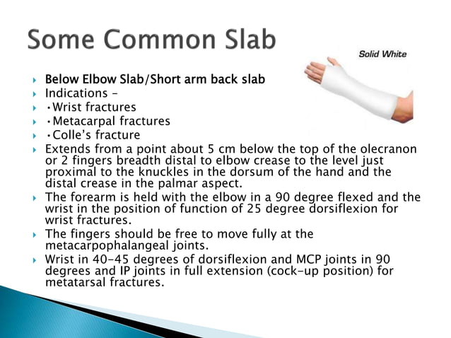 Plaster of paris ortho presentation | PPTX | Death, Injury, or Military ...