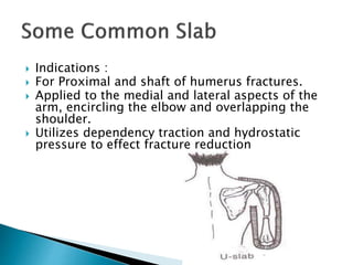 Plaster of paris ortho presentation | PPTX