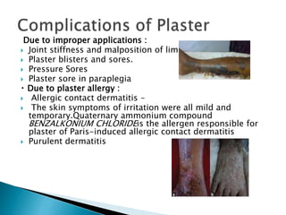 Plaster of paris ortho presentation | PPTX