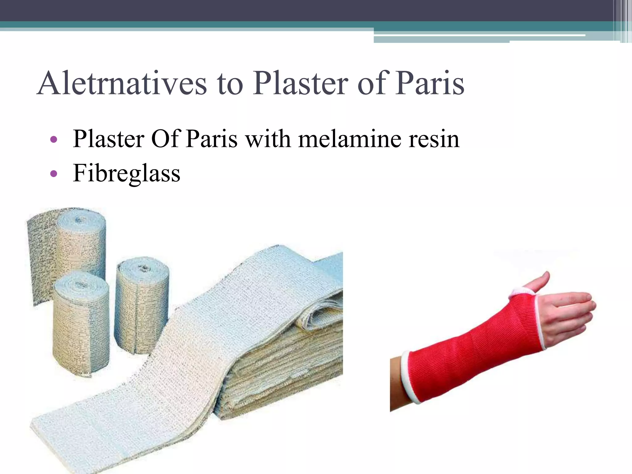 Plaster of paris ,synthetic casts and Functional cast bracing | PPTX