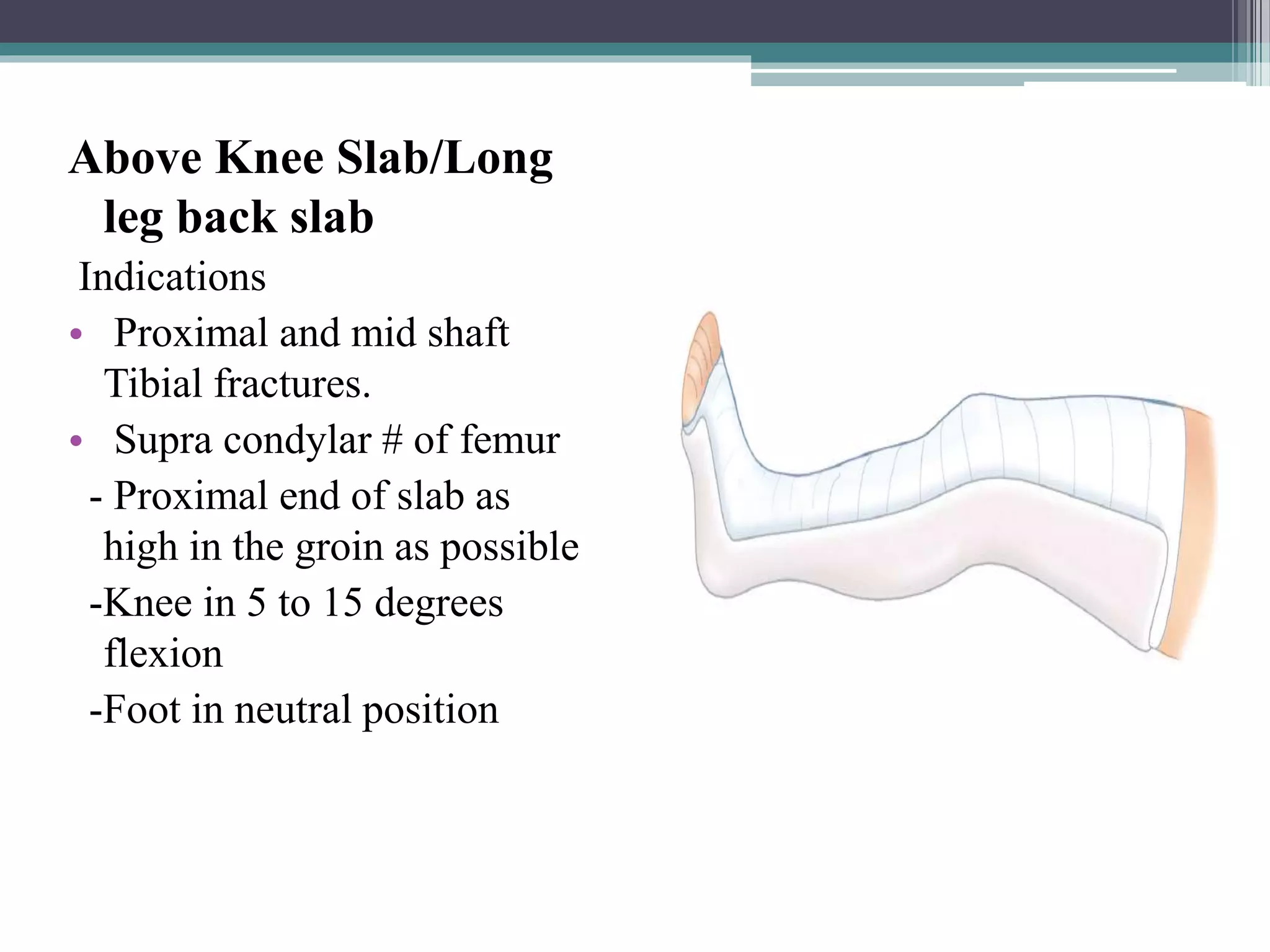 Plaster of paris ,synthetic casts and Functional cast bracing | PPTX