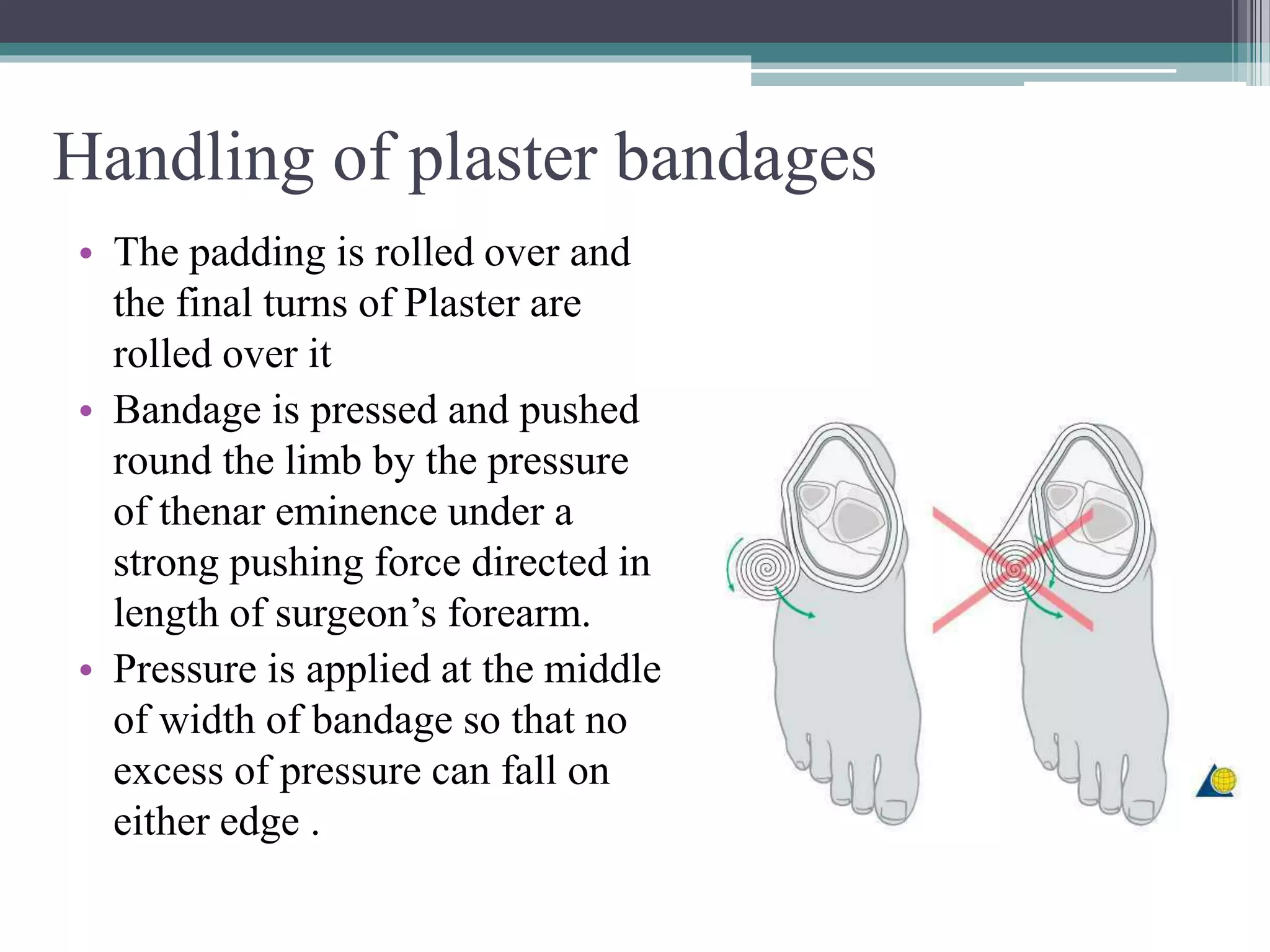 Plaster of paris ,synthetic casts and Functional cast bracing | PPTX