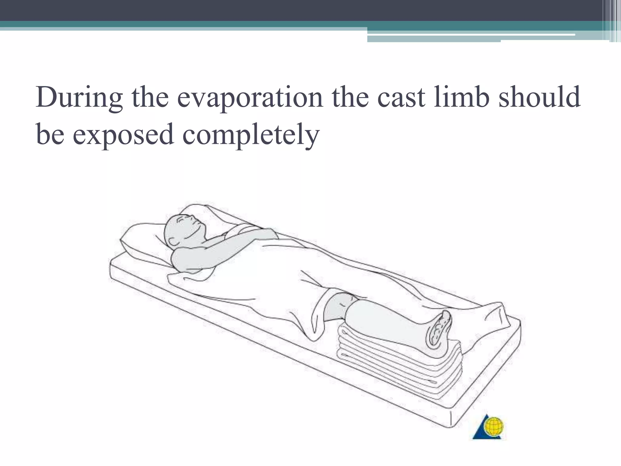 Plaster of paris ,synthetic casts and Functional cast bracing | PPTX