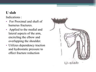 Plaster of paris ,synthetic casts and Functional cast bracing | PPTX