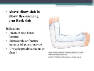 Plaster of paris ,synthetic casts and Functional cast bracing | PPT