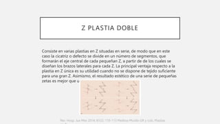 Plastias en z, retraccion de cicatrices. principios de las cirugía ...