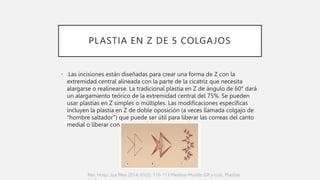 Plastias en z, retraccion de cicatrices. principios de las cirugía ...
