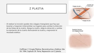 Plastias en z, retraccion de cicatrices. principios de las cirugía ...