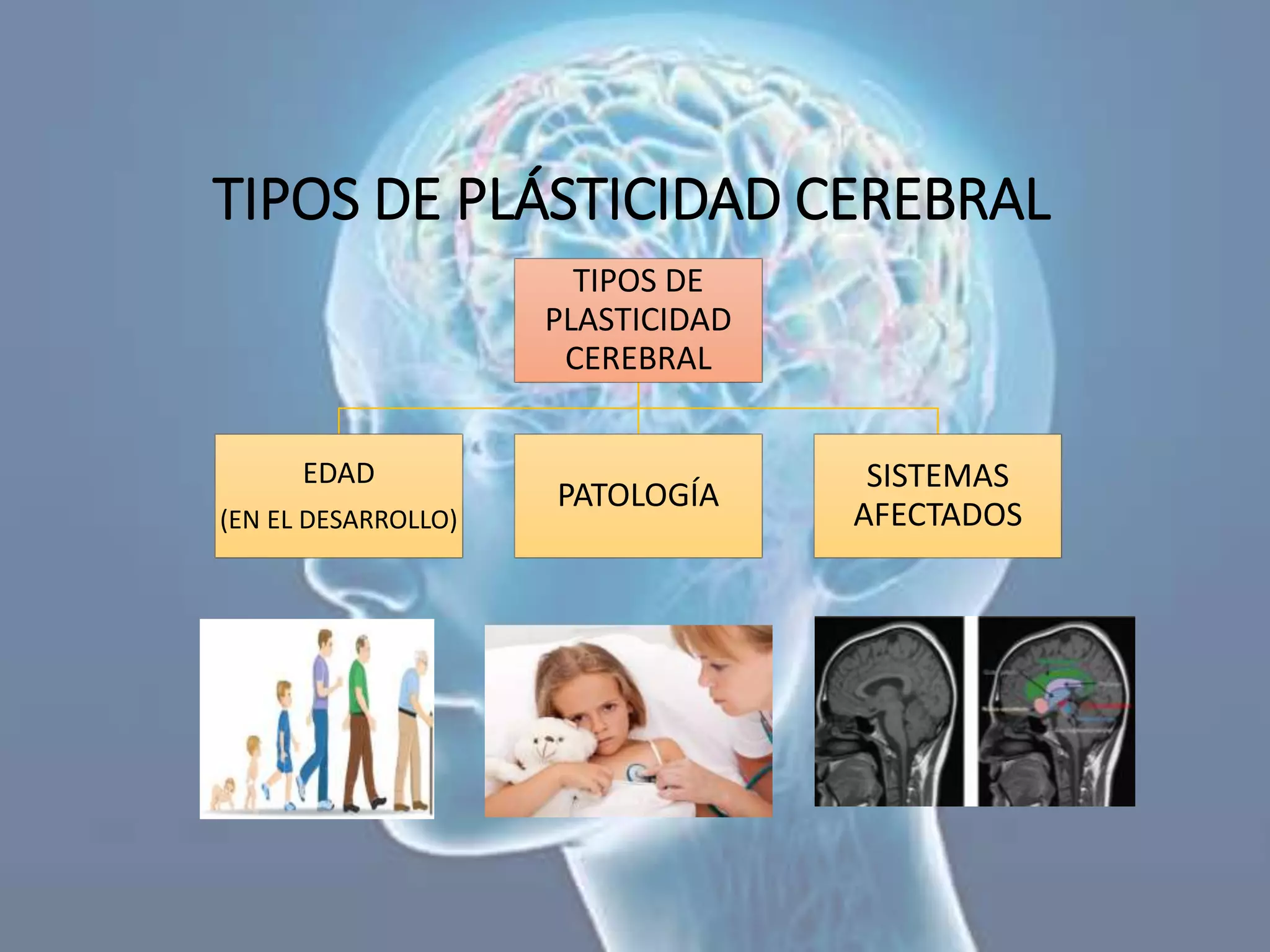 Plasticidad cerebral-diapo | PPT