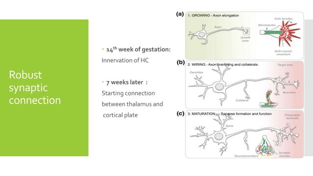 Auditory System Plasticity Pptx