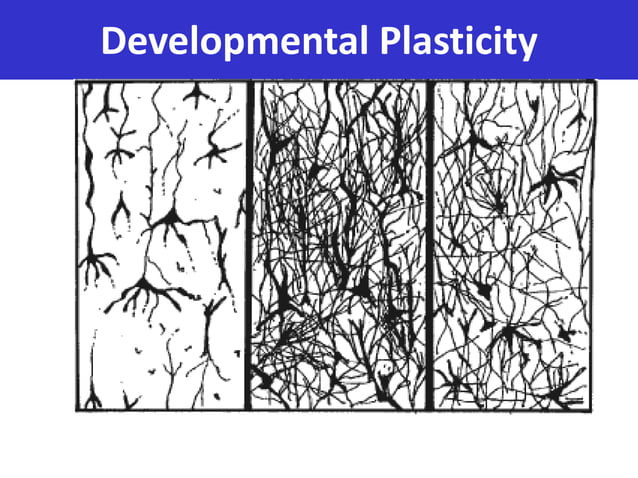 Plasticity of the brain - VCE U4 Psychology | PPTX