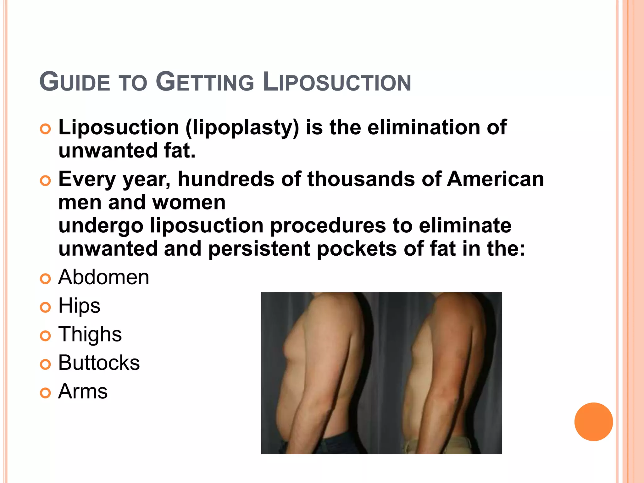 Plastic surgery | PPTX