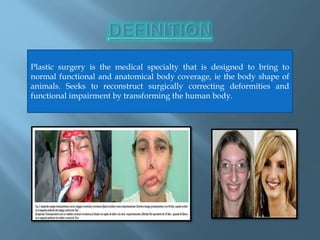 Plastic surgery | PPTX