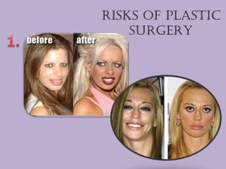 Plastic surgery | PPT