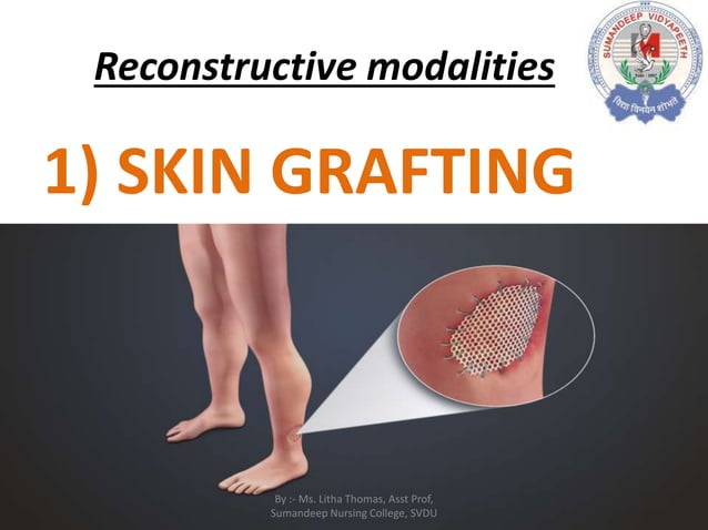 Plastic surgery | PPT