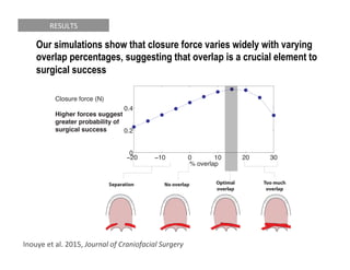 Helping plastic surgeons improve cleft palate surgery | PPT