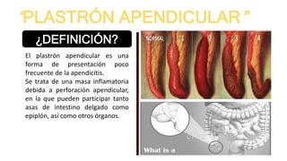 PLASTRÓN APENDICULAR.pptx