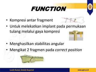 Internal fixation | PPT