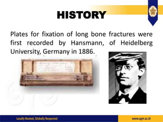 Internal fixation | PPT