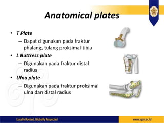 Internal fixation | PPT