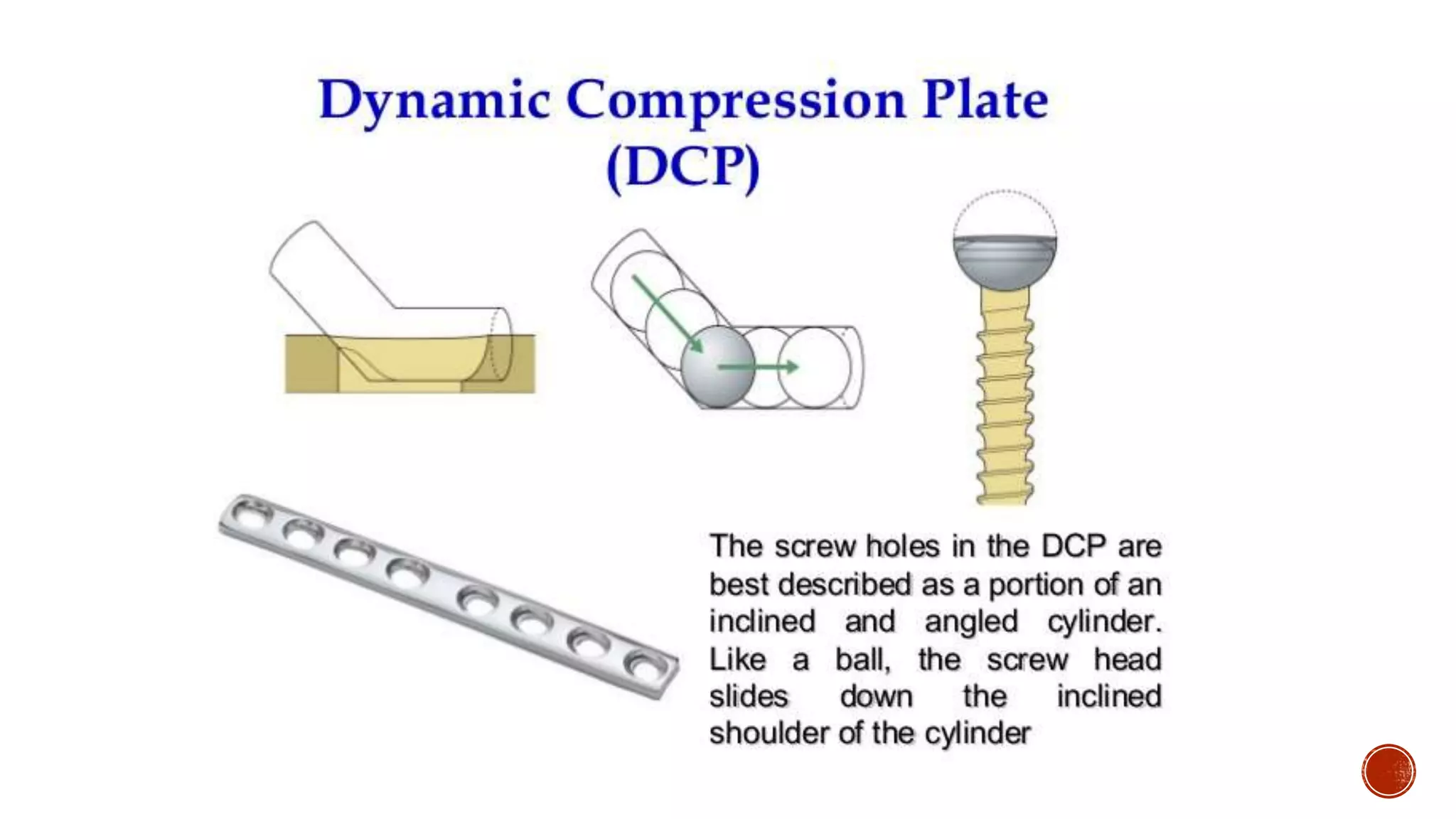 Orthopaedic Plates - types and applications | PPTX