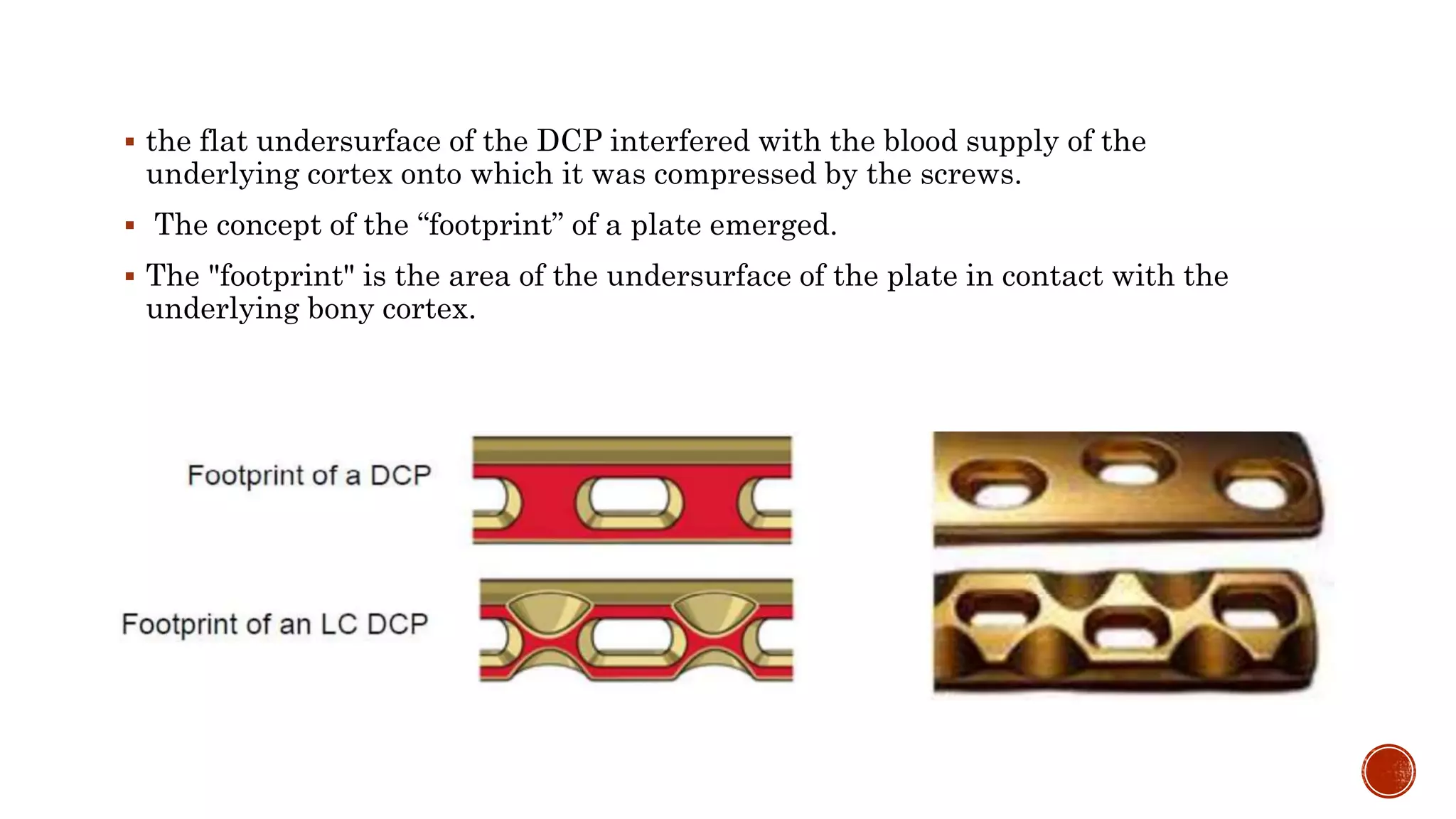 Orthopaedic Plates - types and applications | PPTX