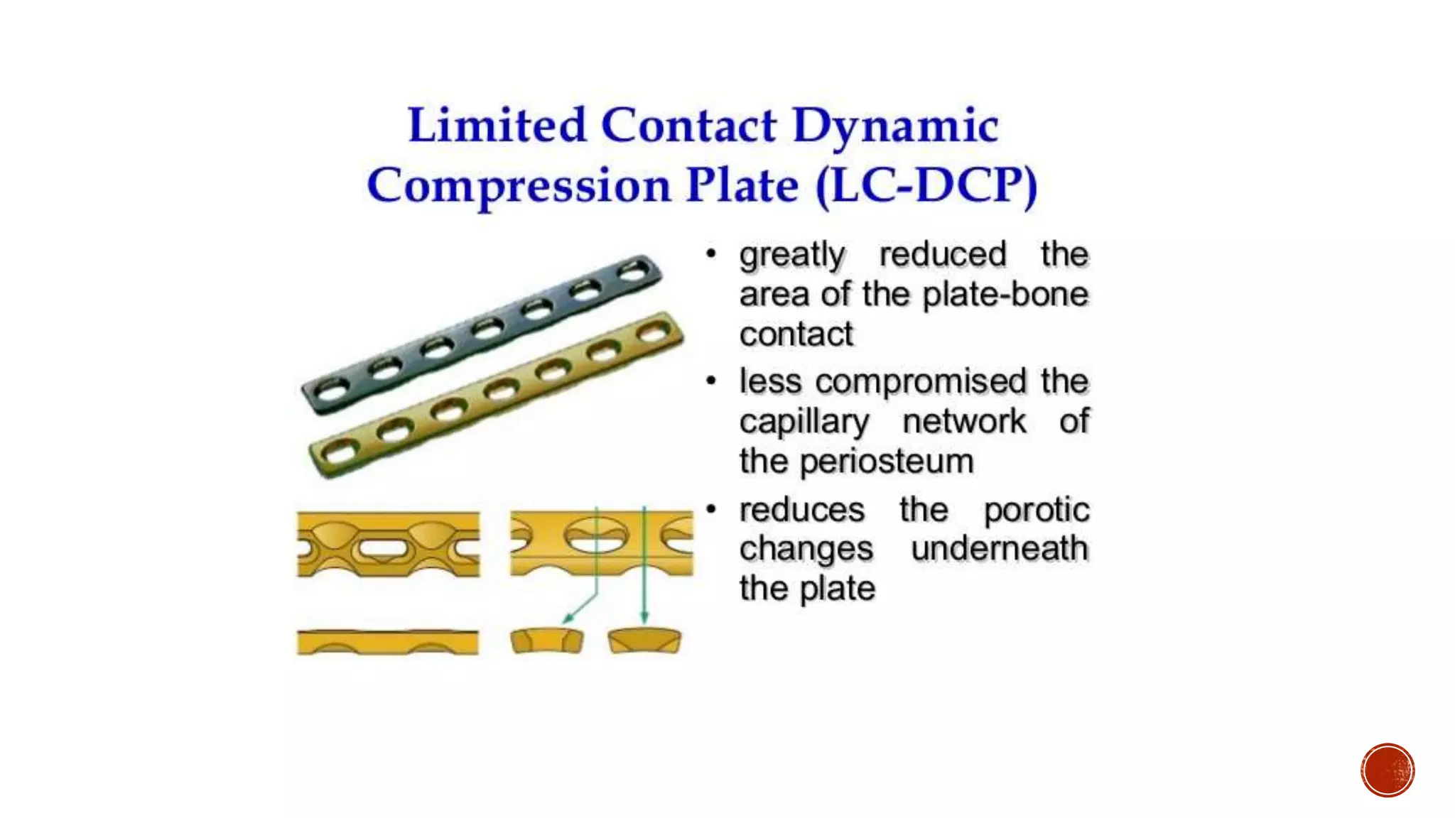 Orthopaedic Plates - types and applications | PPTX
