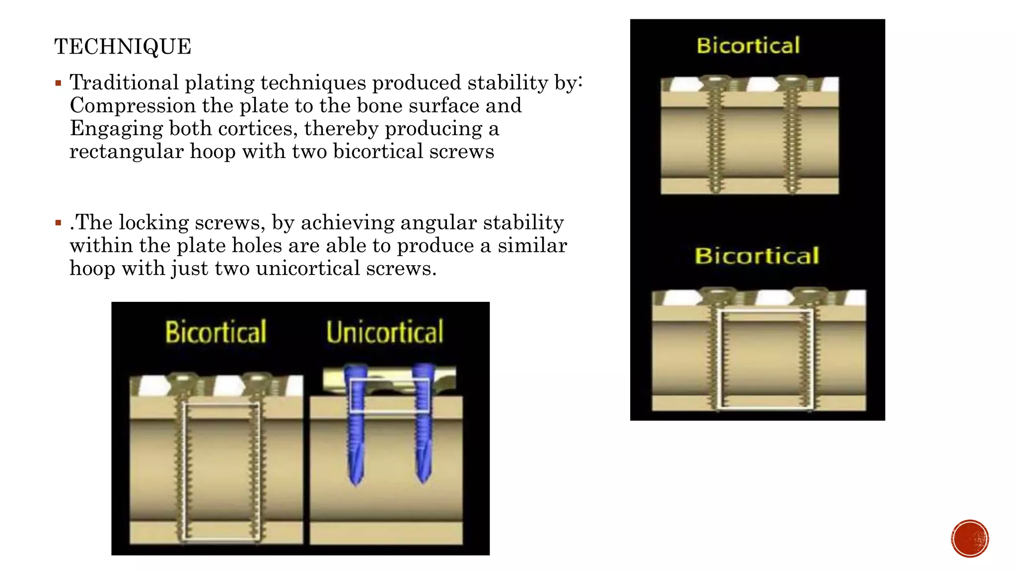 Orthopaedic Plates - types and applications | PPTX