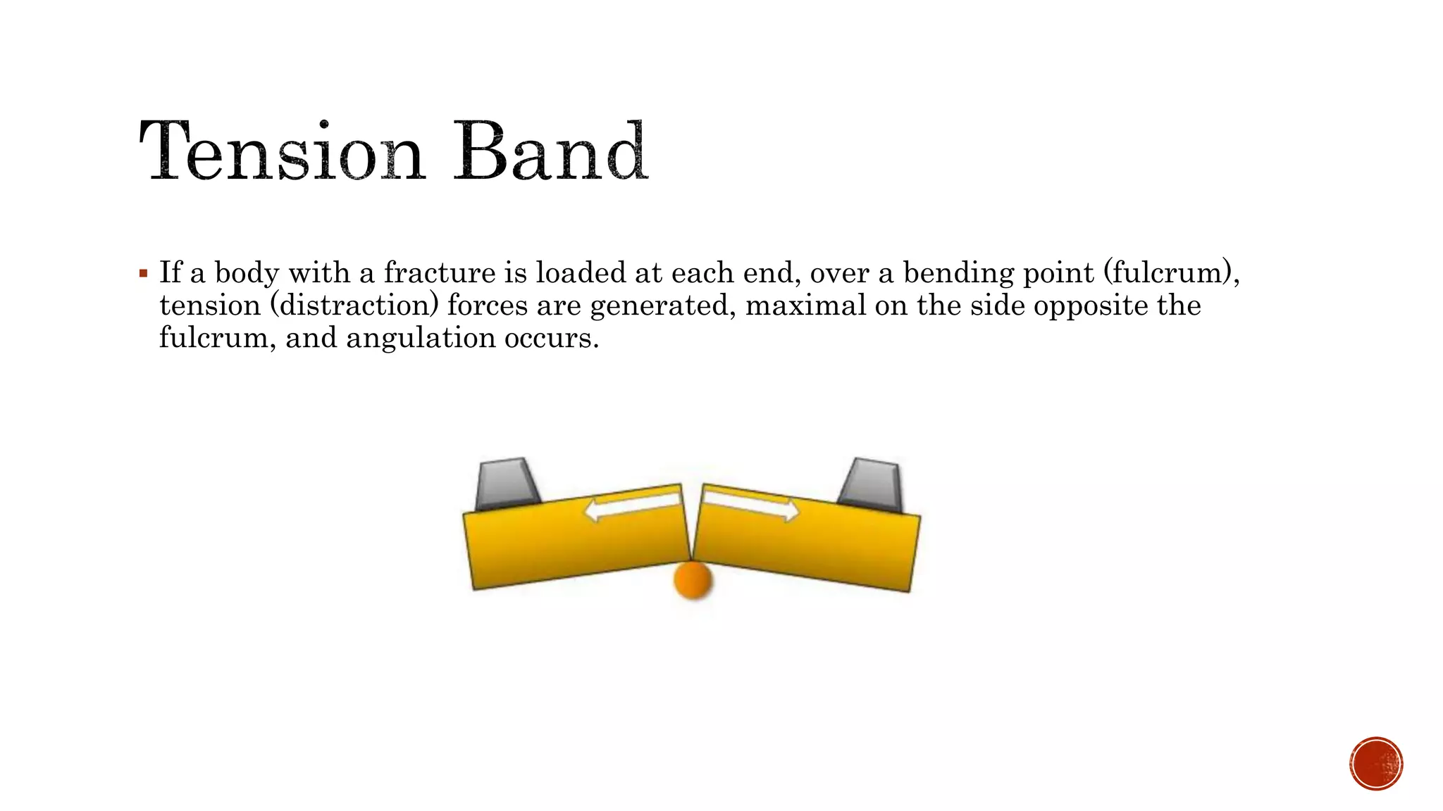 Orthopaedic Plates - types and applications | PPTX