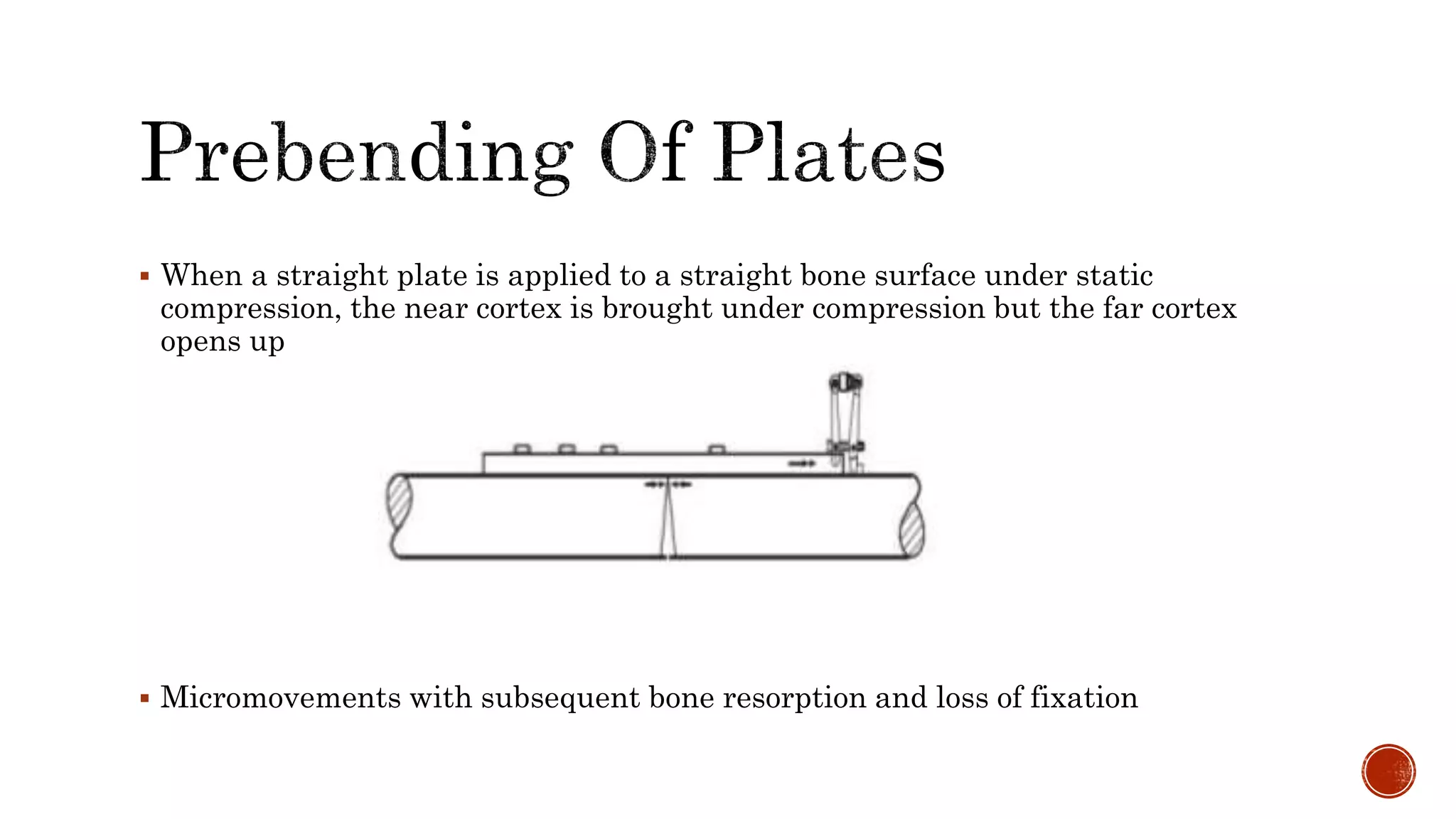 Orthopaedic Plates - types and applications | PPTX