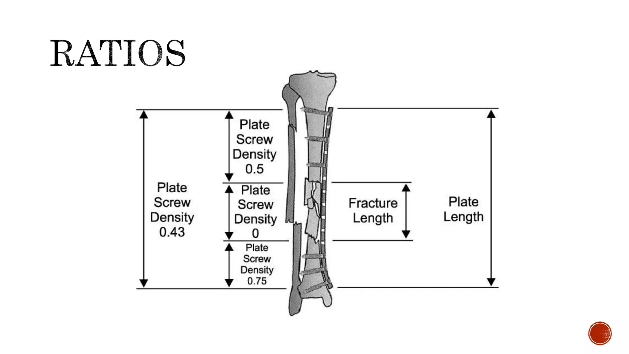 Orthopaedic Plates - types and applications | PPTX