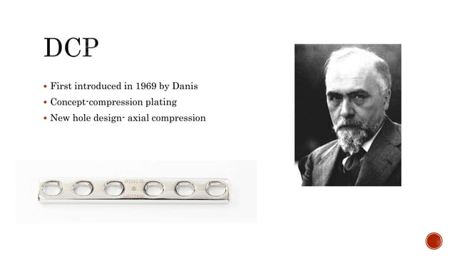 Orthopaedic Plates - types and applications | PPTX