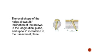 Orthopaedic Plates - types and applications | PPTX