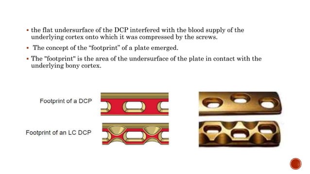 Orthopaedic Plates - types and applications | PPTX
