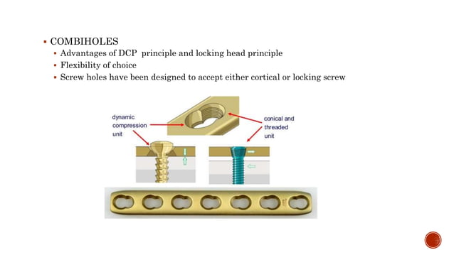 Orthopaedic Plates - types and applications | PPTX