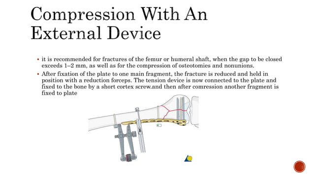 Orthopaedic Plates - types and applications | PPTX