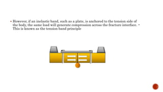 Orthopaedic Plates - types and applications | PPTX