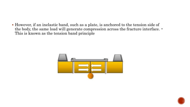 Orthopaedic Plates - types and applications | PPTX