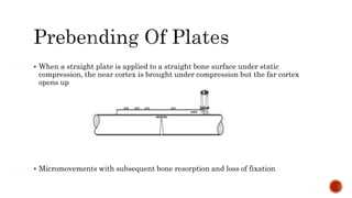 Orthopaedic Plates - types and applications | PPTX