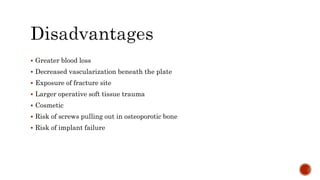 Orthopaedic Plates - types and applications | PPTX