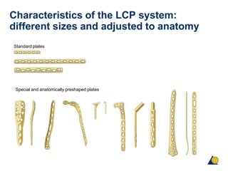 plate and screw AO.pptx