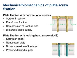 plate and screw AO.pptx