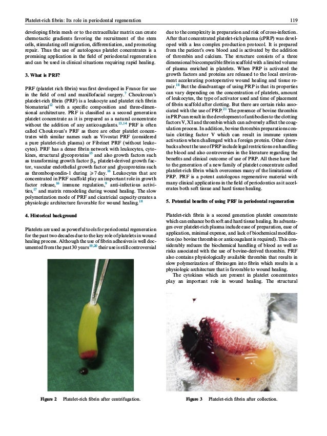 Platelet-rich-fibrin--Its-role-in-periodont_2014_The-Saudi-Journal-for ...